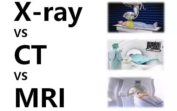 怎样读懂体检报告（六）- X线、CT、核磁共振（MRI）的区别-健康教育-漯河市中心医院